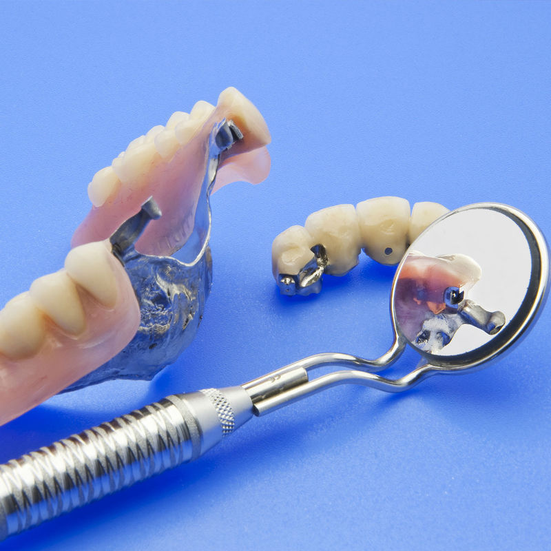 Tratamientos dentales en Huesca: ortodoncia, implantes, blanqueamiento